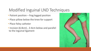 Inguinal LND.pptx