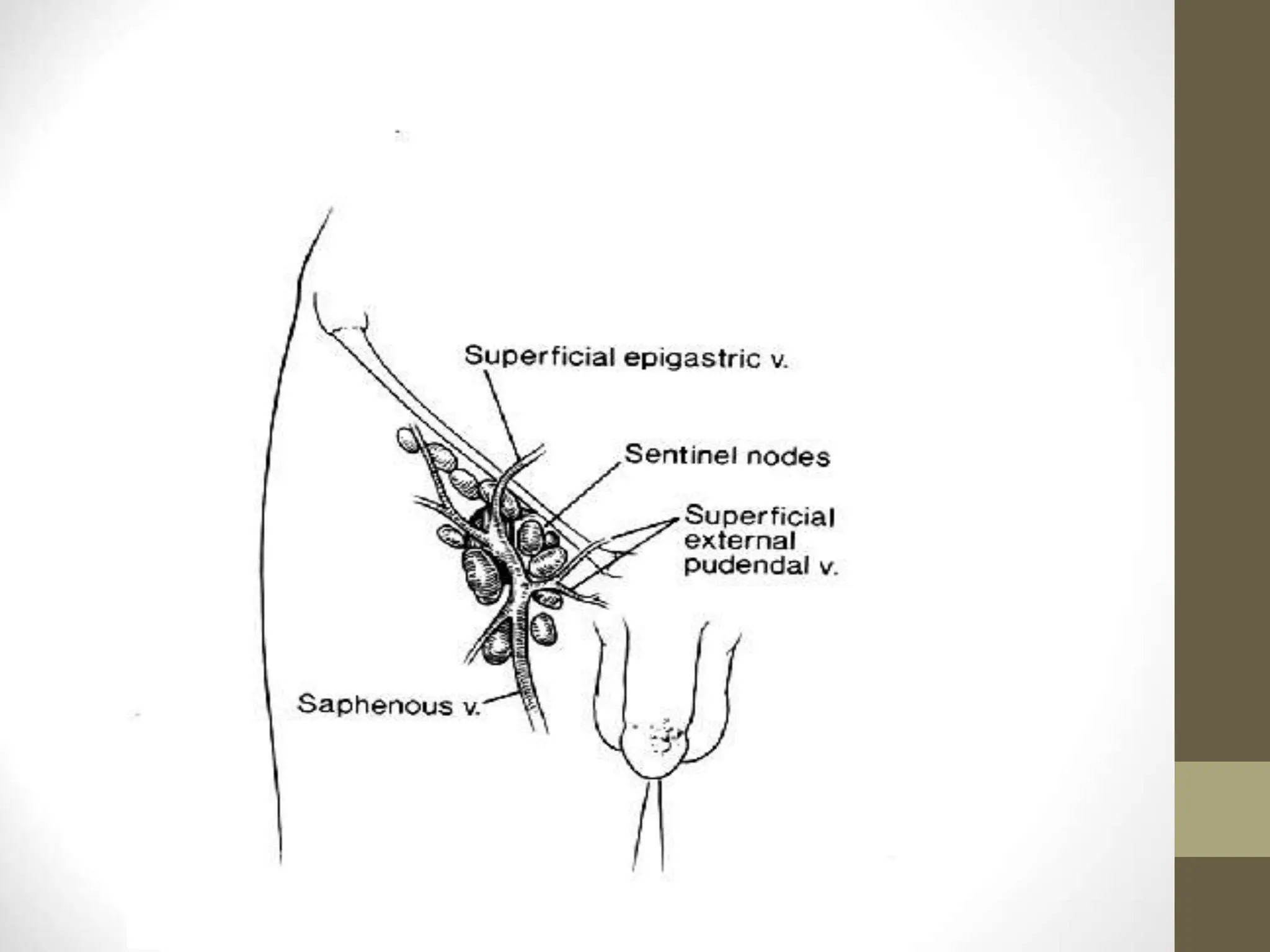 Inguinal Lymph Nodes Ppt