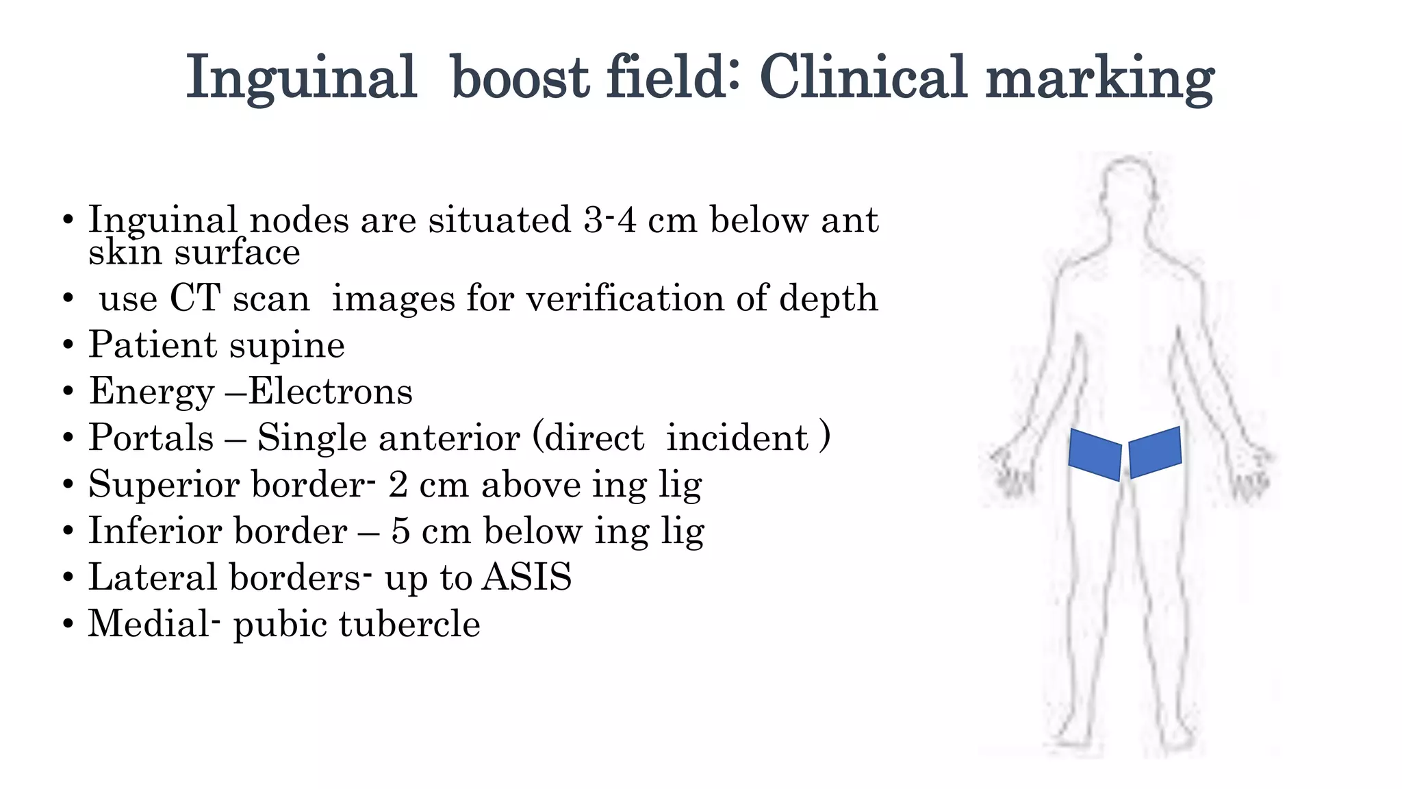 Techniques for Inguinal/Groin Irradiation | PPTX