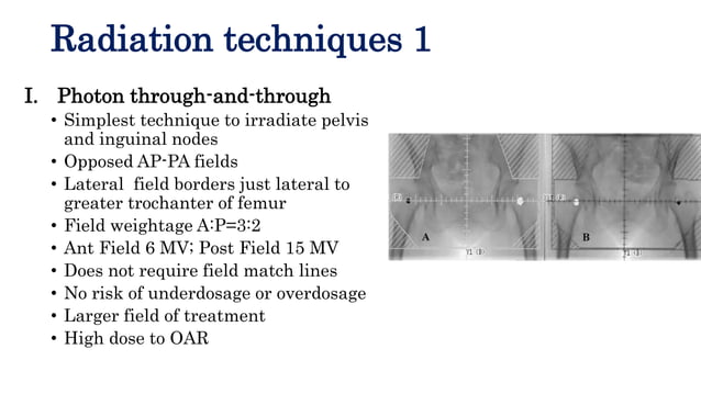 Techniques for Inguinal/Groin Irradiation | PPTX | Physical Therapy ...