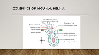 Anatomy of the Inguinoscrotal Region brief about direct and indirect ...