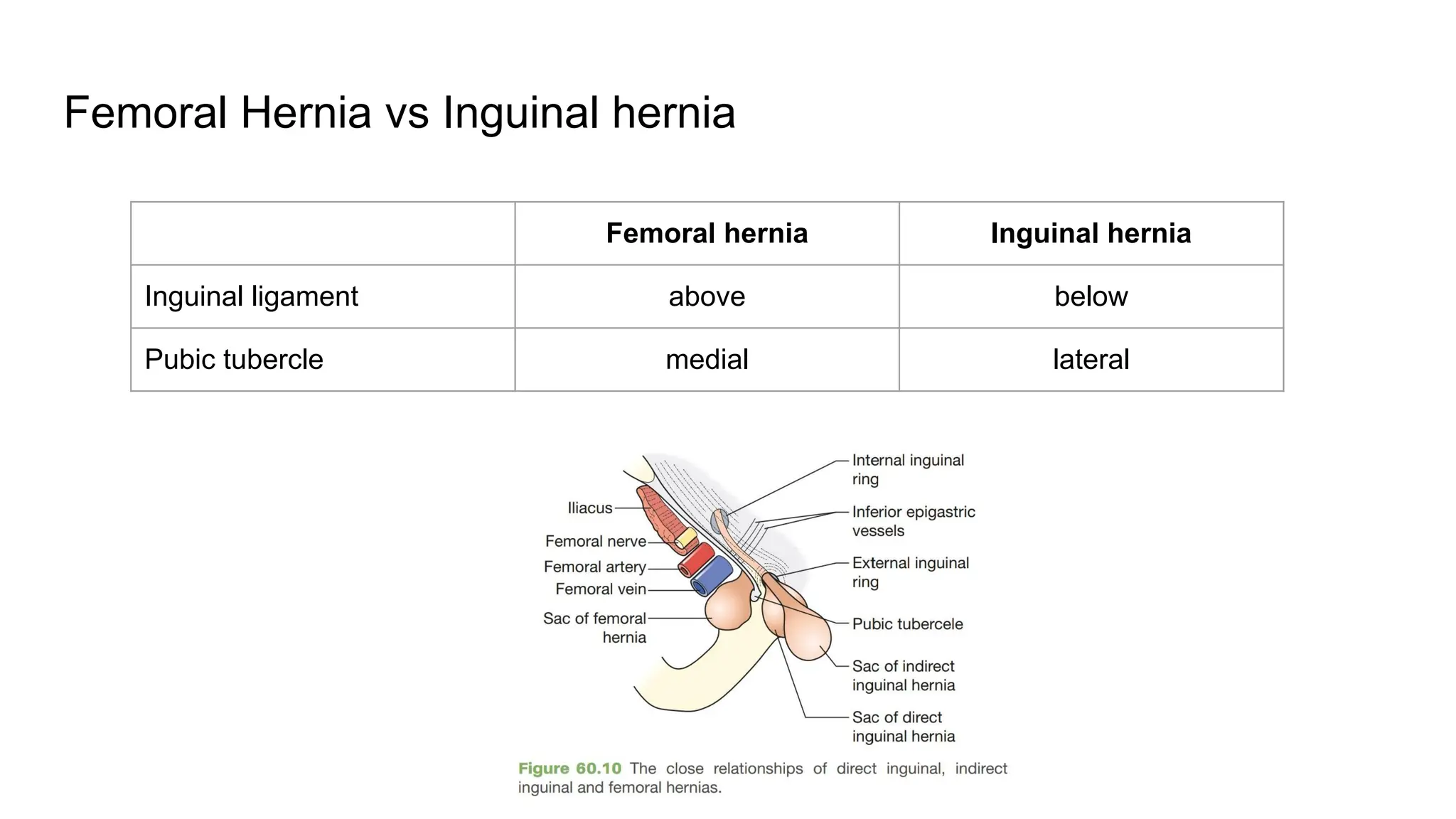 Inguinal Swelling and Undescended Testis (1).pdf