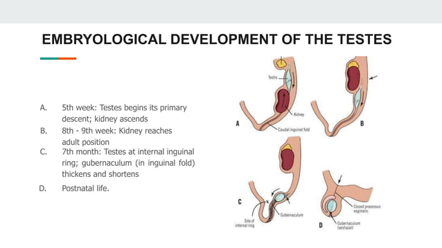 Inguinal Swelling and Undescended Testis (1).pdf