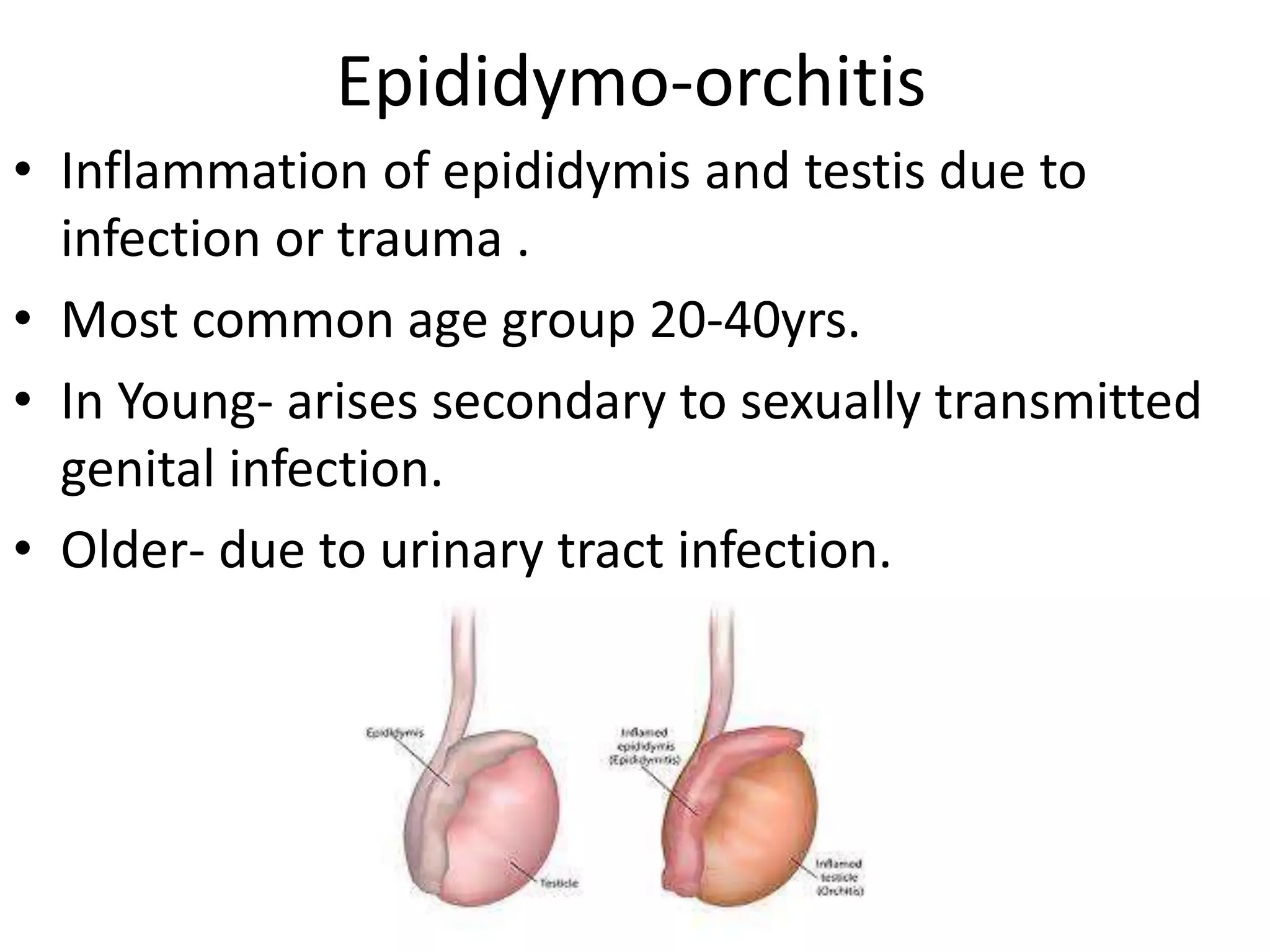 INGUINO-SCROTAL SWELLINGS.pptx