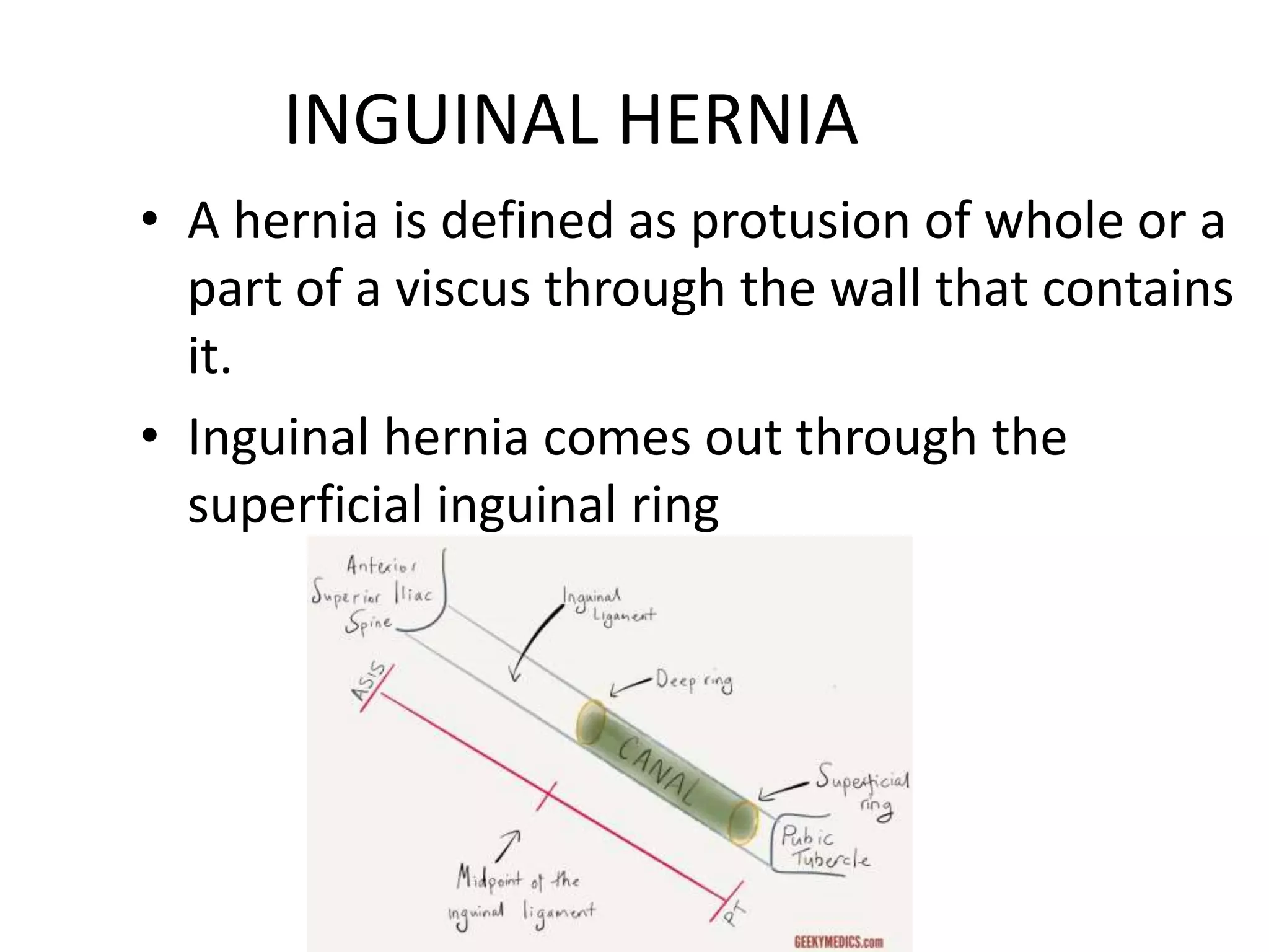 INGUINO-SCROTAL SWELLINGS.pptx