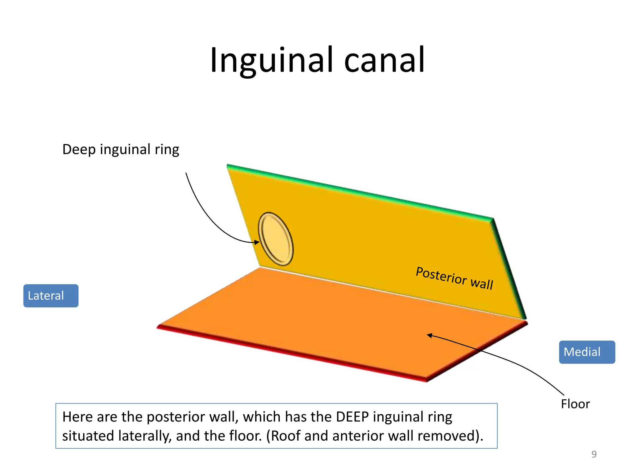 inguinoscrotal surical conditions-lituli.pptx