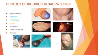 INGUINOSCROTAL SWELLING | PPT