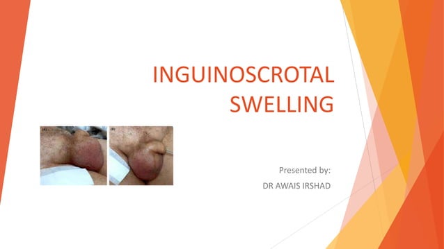 INGUINOSCROTAL SWELLING | PPT