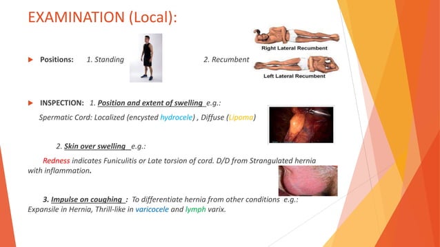 INGUINOSCROTAL SWELLING | PPT