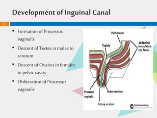 Inguninal hernia pbl | PPT