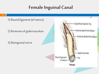 Inguninal hernia pbl | PPTX