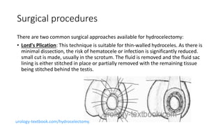 inguinoscrotal swellings ( Inguinal Hernia , Hydrocele ) | PPTX