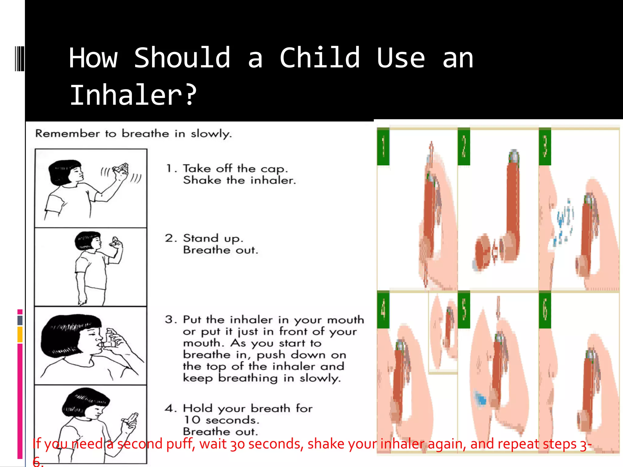 Inhalars for bronchial asthma | PPTX