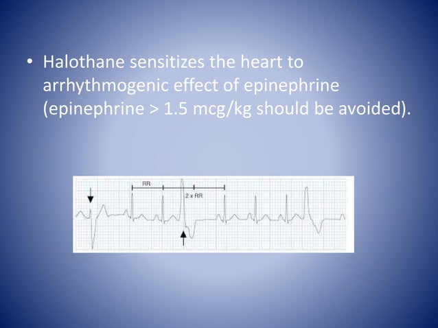 Inhalational Anesthetics; Nitrous Oxide and Halothane.pptx | Lung and ...