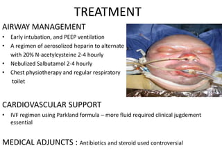 Inhalational burns injury | PPTX