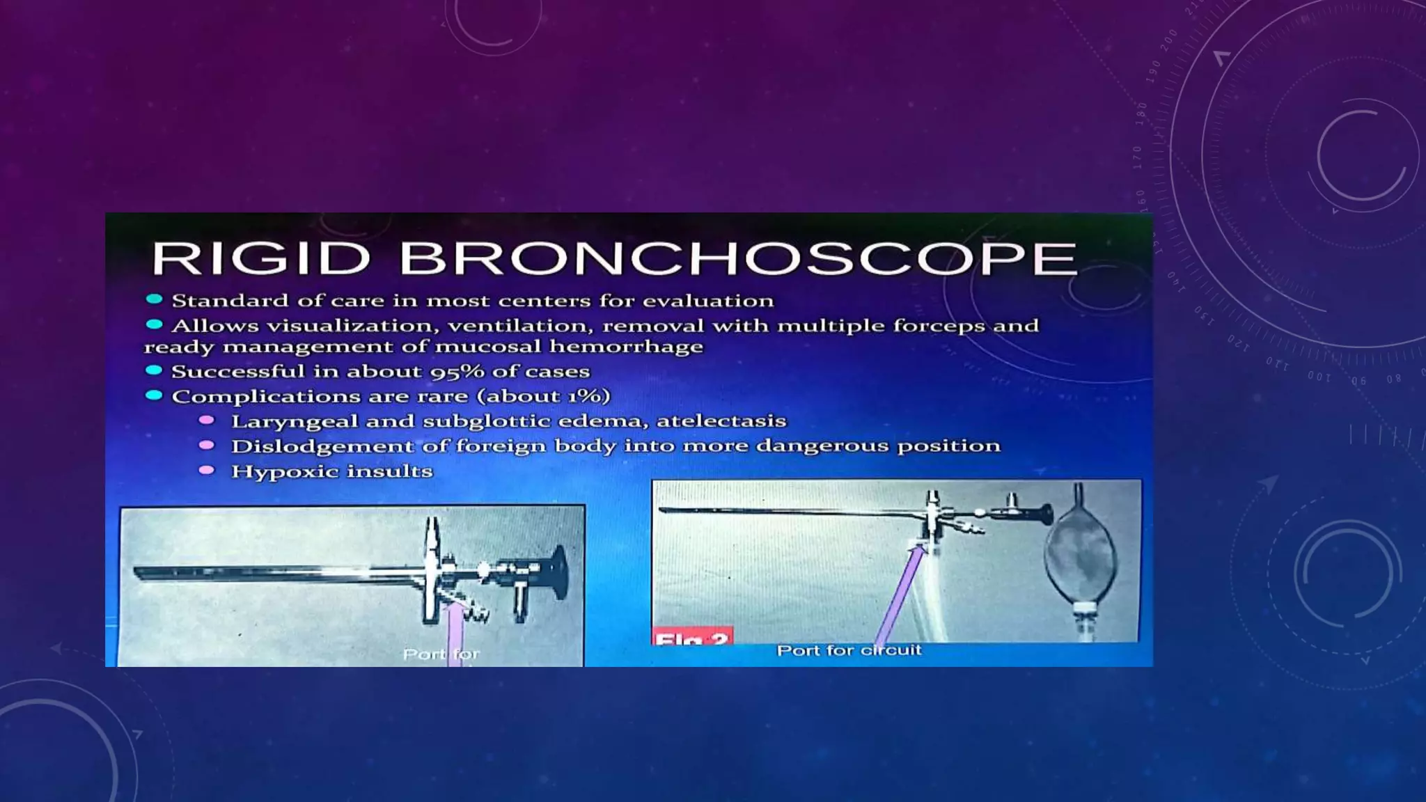 Inhaled foreign body.pptx