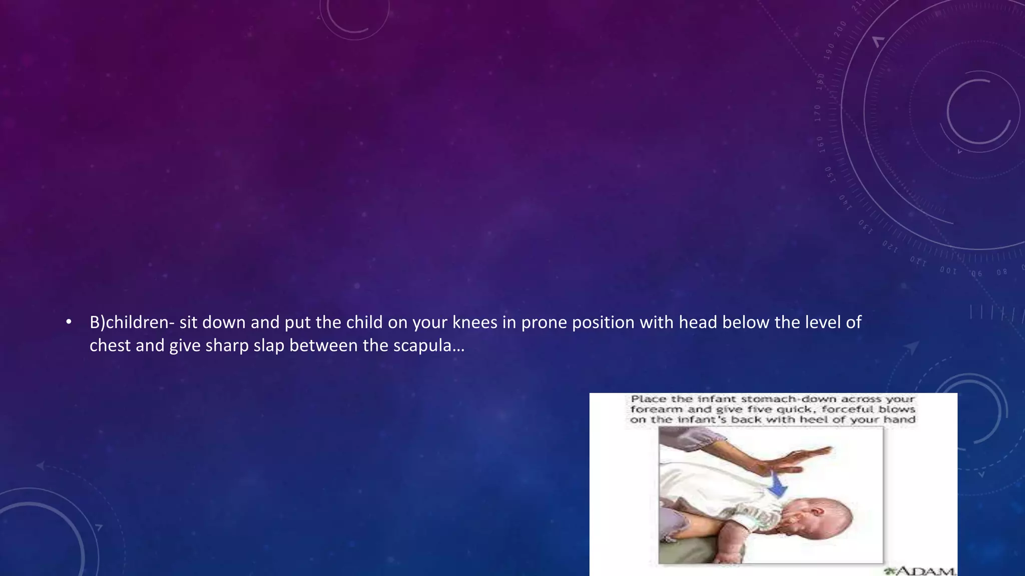 Inhaled foreign body.pptx