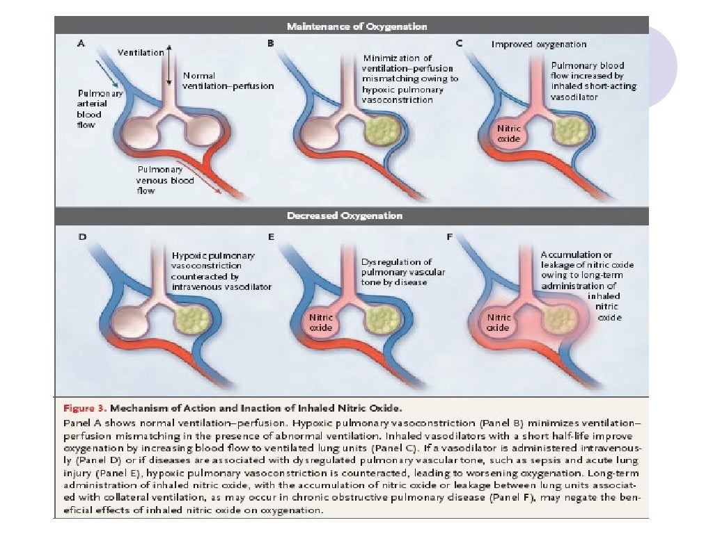 Inhaled nitric oxide therapy in adults