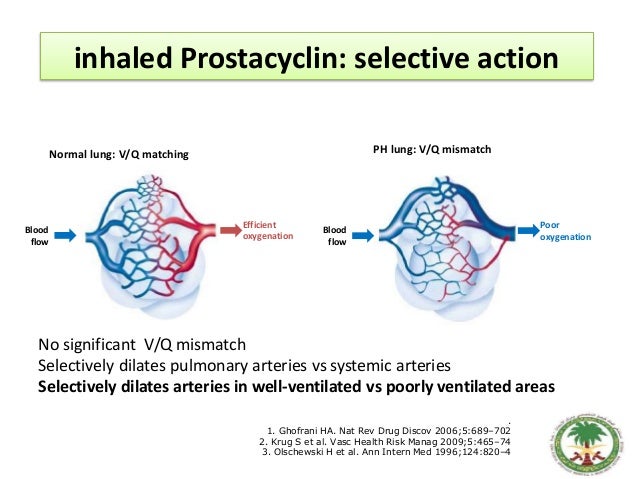 Inhaled Prostacyclins