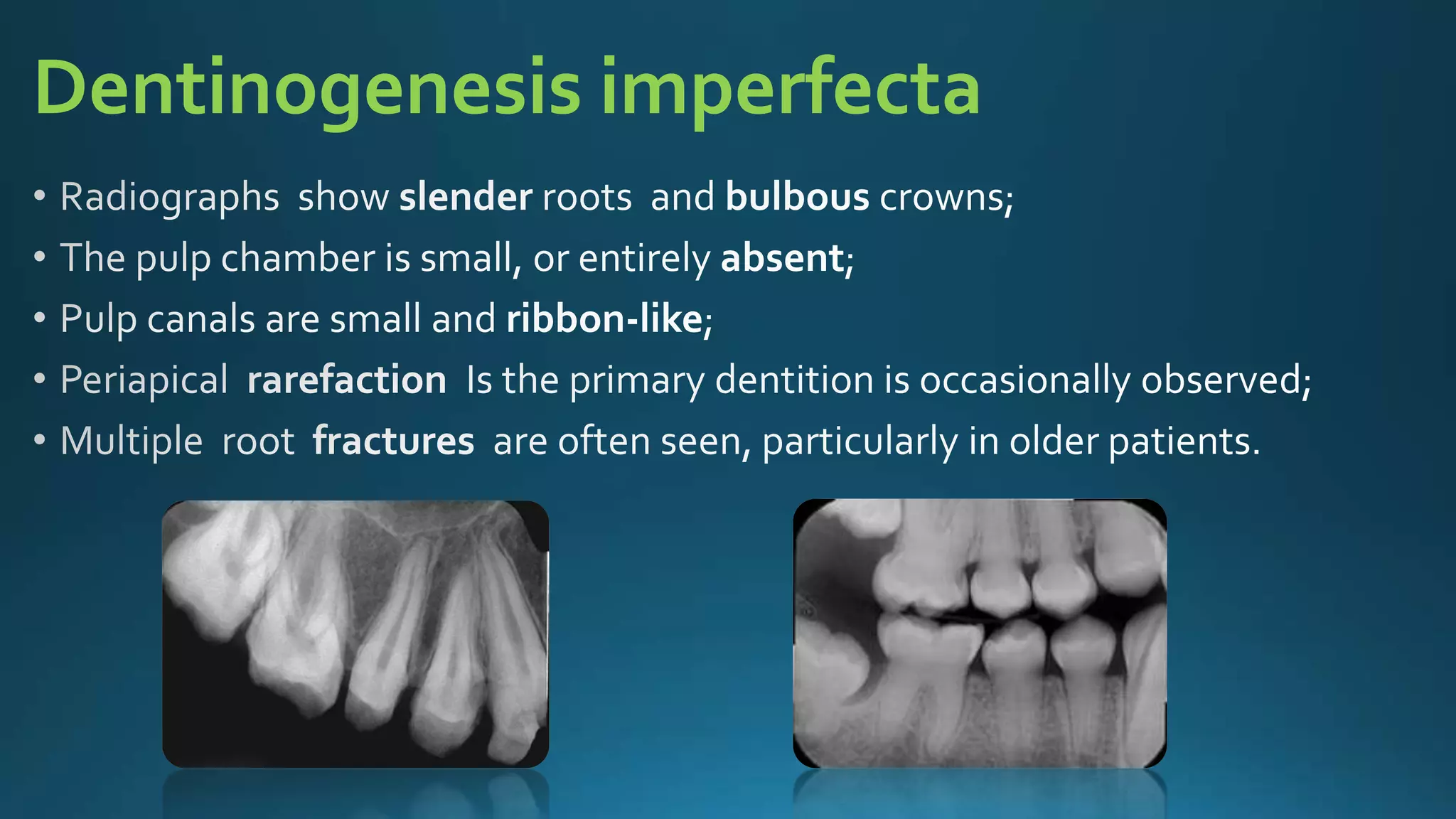 Inherited dentin defects (Dentistry) | PPTX