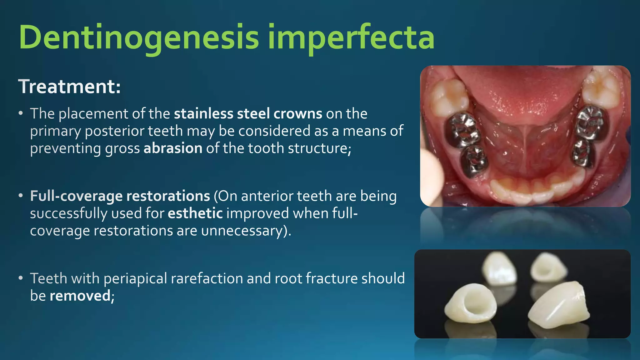 Inherited dentin defects (Dentistry) | PPTX
