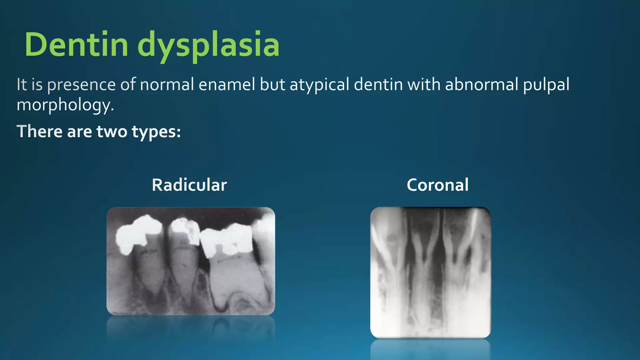 Inherited dentin defects (Dentistry) | PPTX