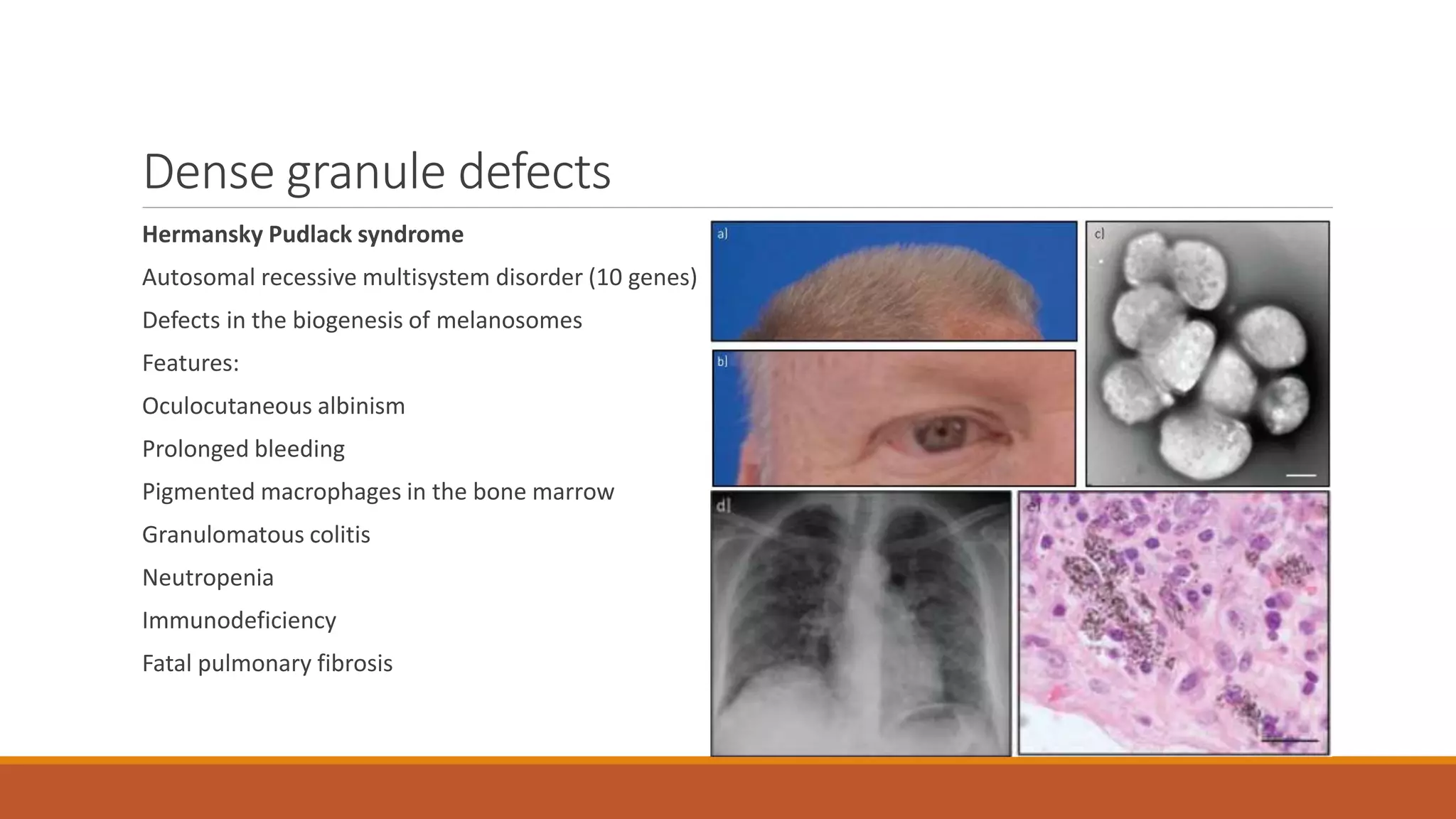 INHERITED PLATELET DISORDERS (1).pptx