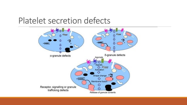 INHERITED PLATELET DISORDERS (1).pptx | Blood Disorders | Diseases and ...
