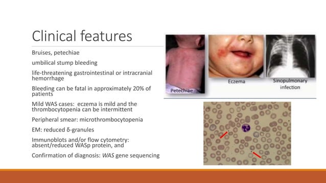 INHERITED PLATELET DISORDERS (1).pptx | Blood Disorders | Diseases and ...