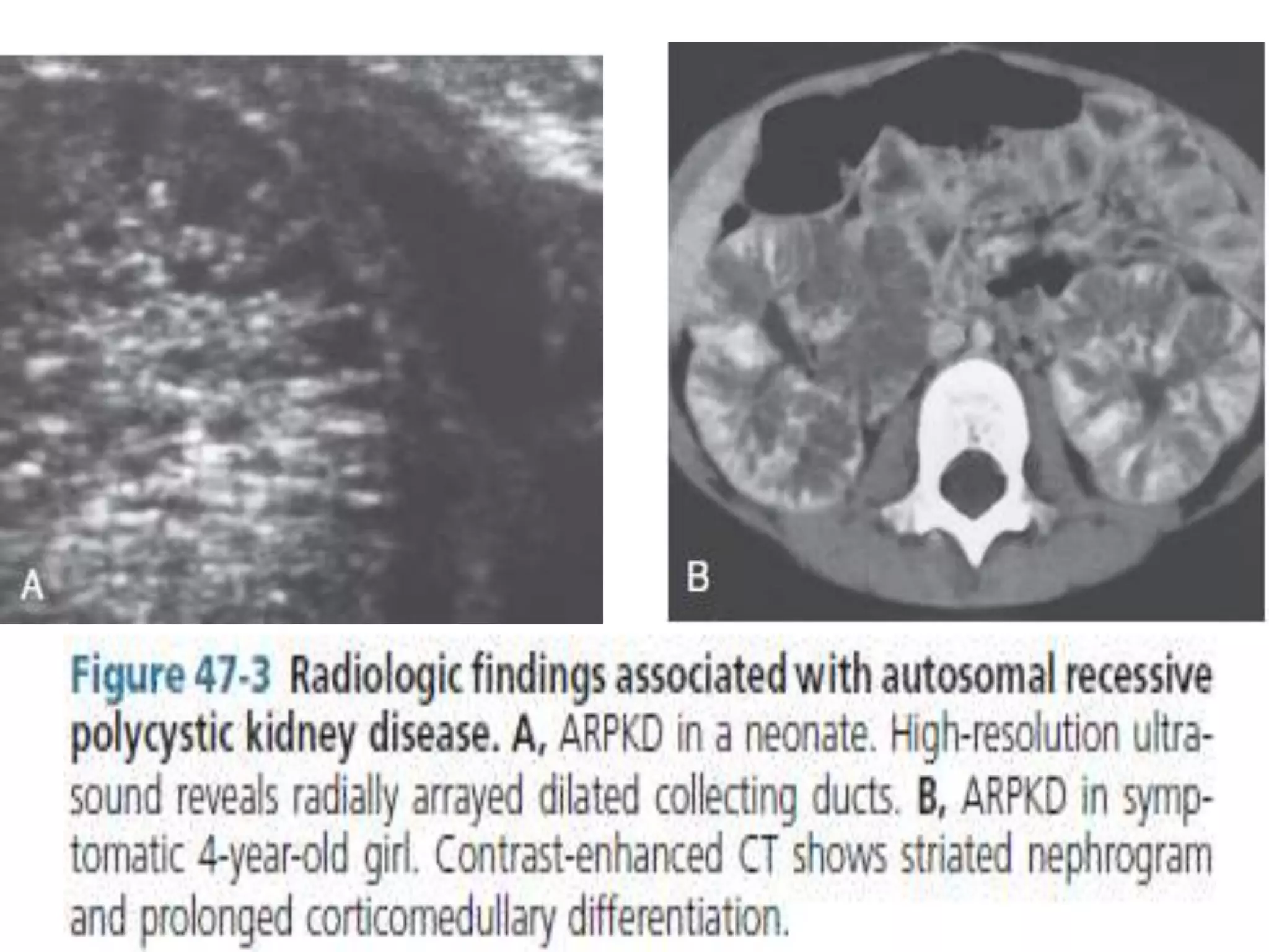 Inherited tubular disorders | PPTX