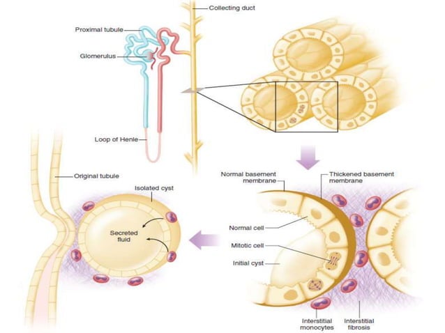 Inherited tubular disorders | PPTX