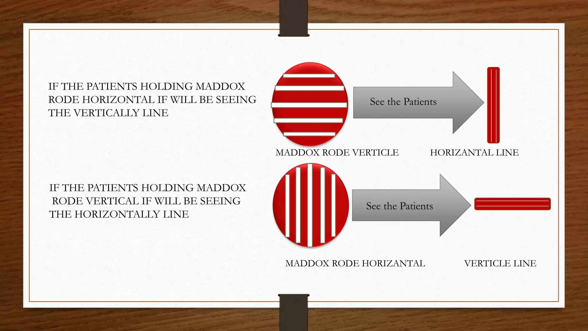 Maddox rode | PDF | Eye and Vision Conditions | Diseases and Conditions