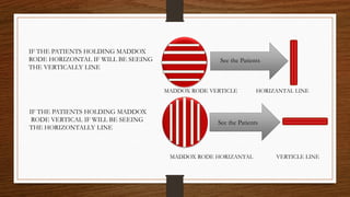 Maddox rode | PDF | Eye and Vision Conditions | Diseases and Conditions