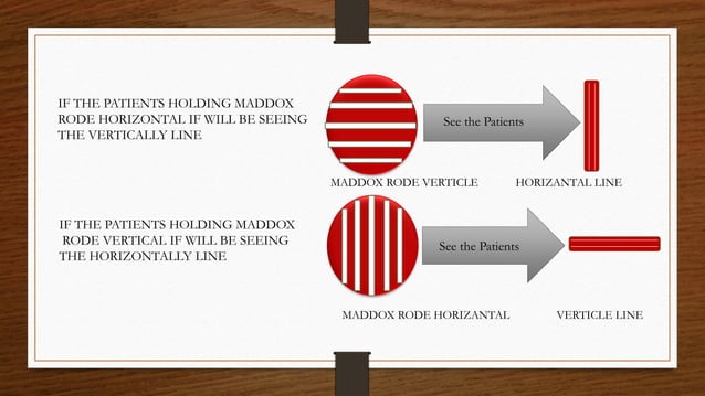 Maddox rode | PDF | Eye and Vision Conditions | Diseases and Conditions