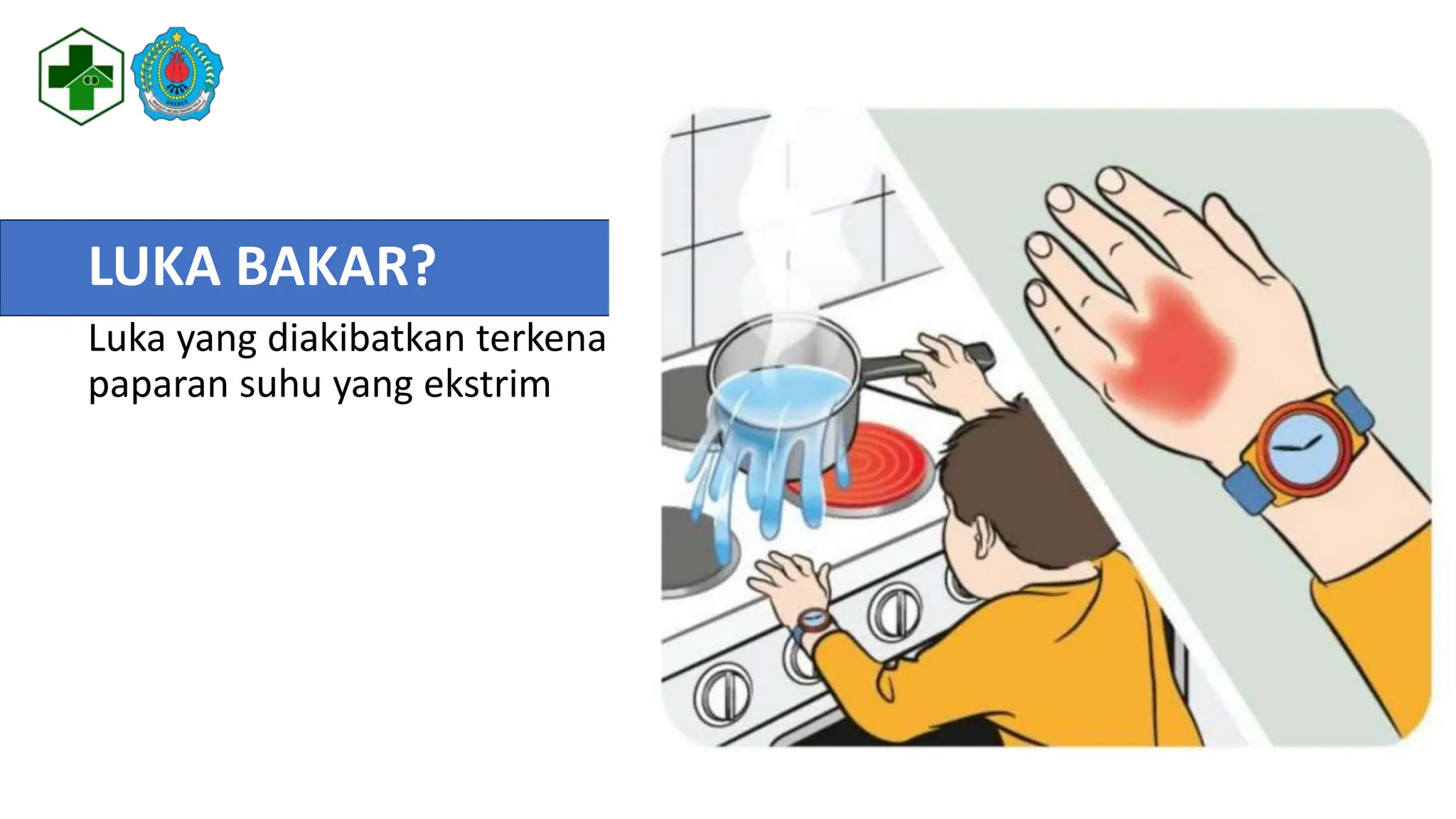 pertolongan luka anak sd.pptx