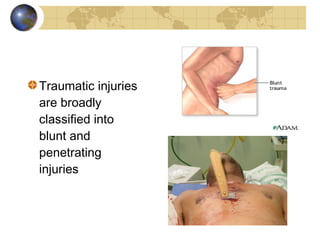 Initial approach to trauma | PPT