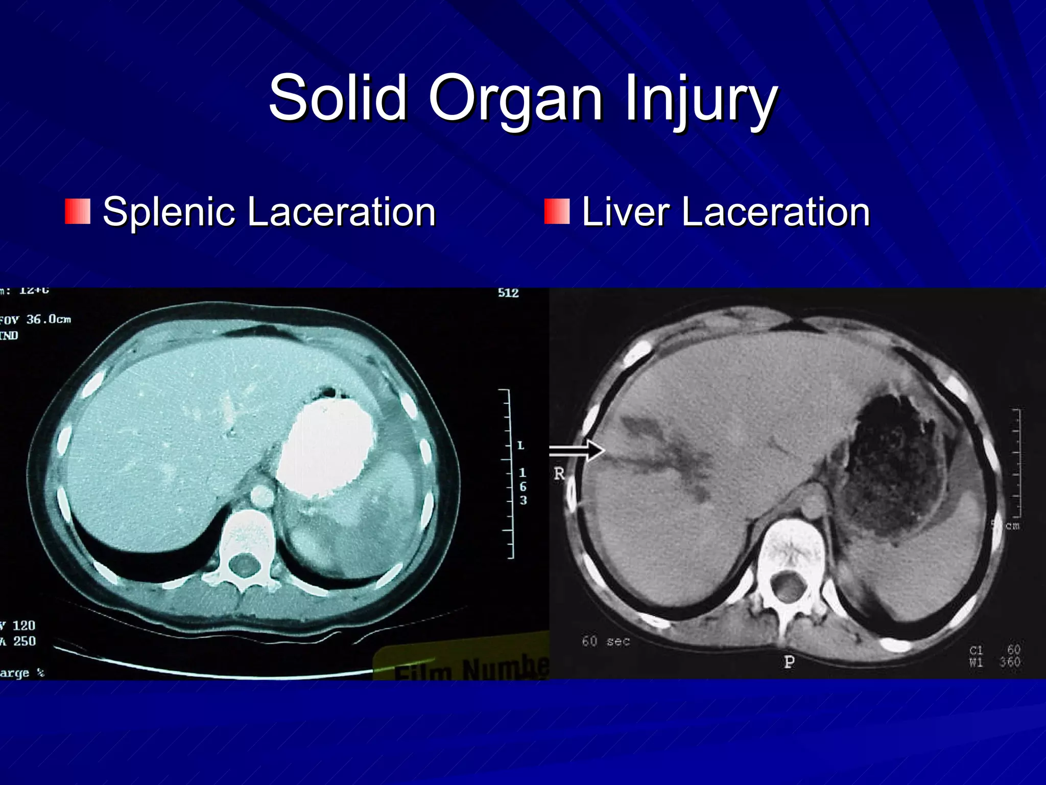 Initial assessment of the trauma patient | PPT