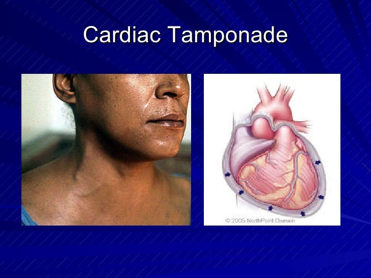 Initial assessment of the trauma patient