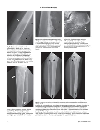 Initial of primary bone tumour | PDF