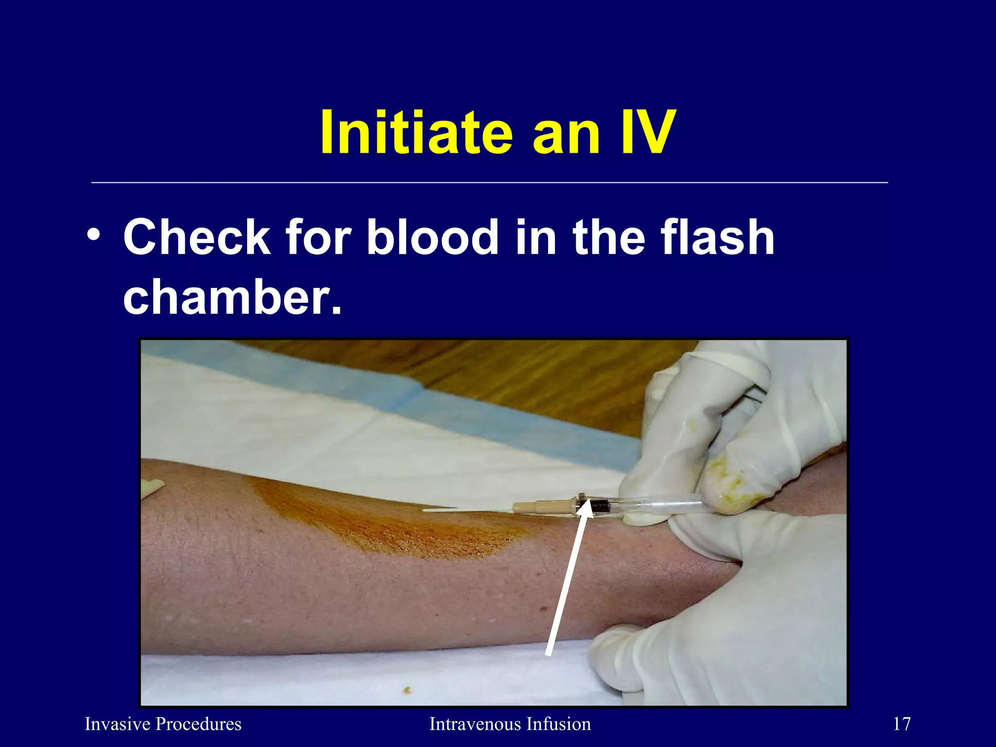 Initiate an iv therapy | PPT