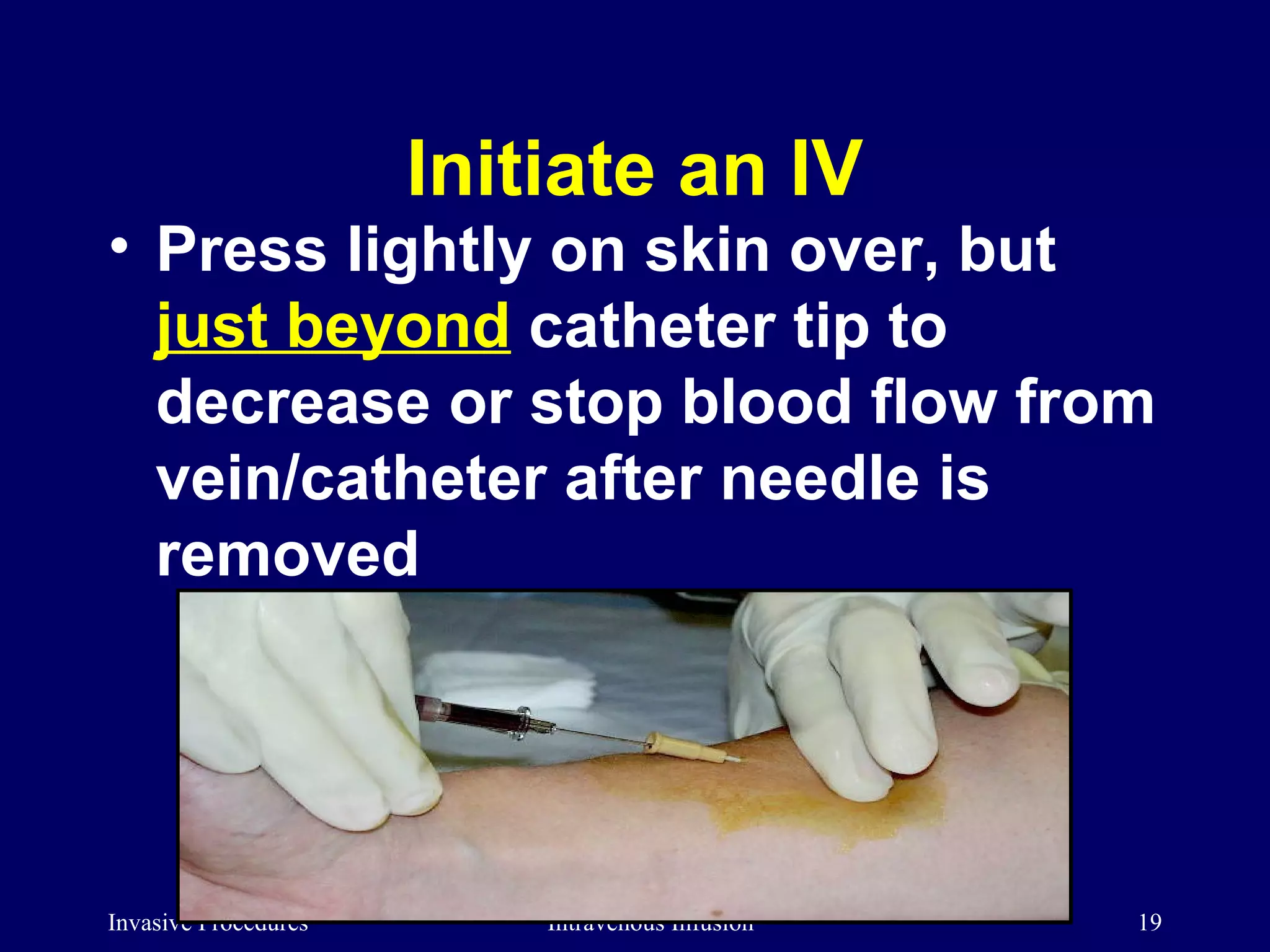 Initiate an iv therapy | PPT