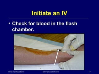 Initiate an iv therapy | PPT