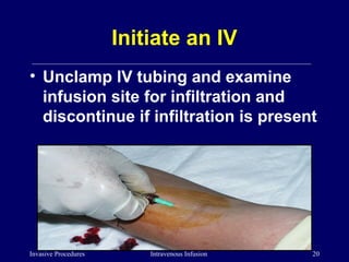 Initiate an iv therapy | PPT