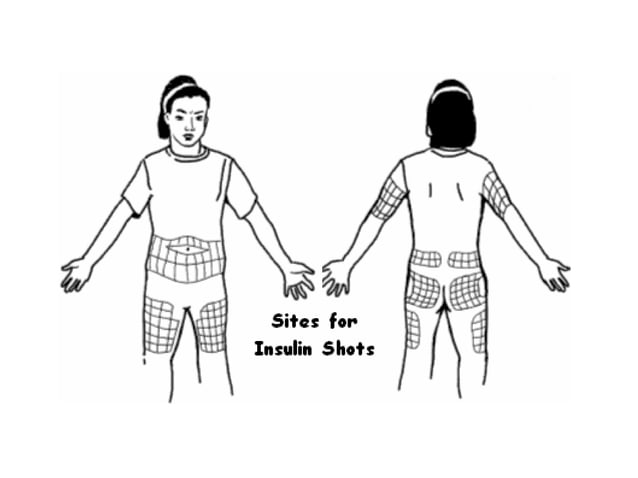 Inject Insulin | PPT