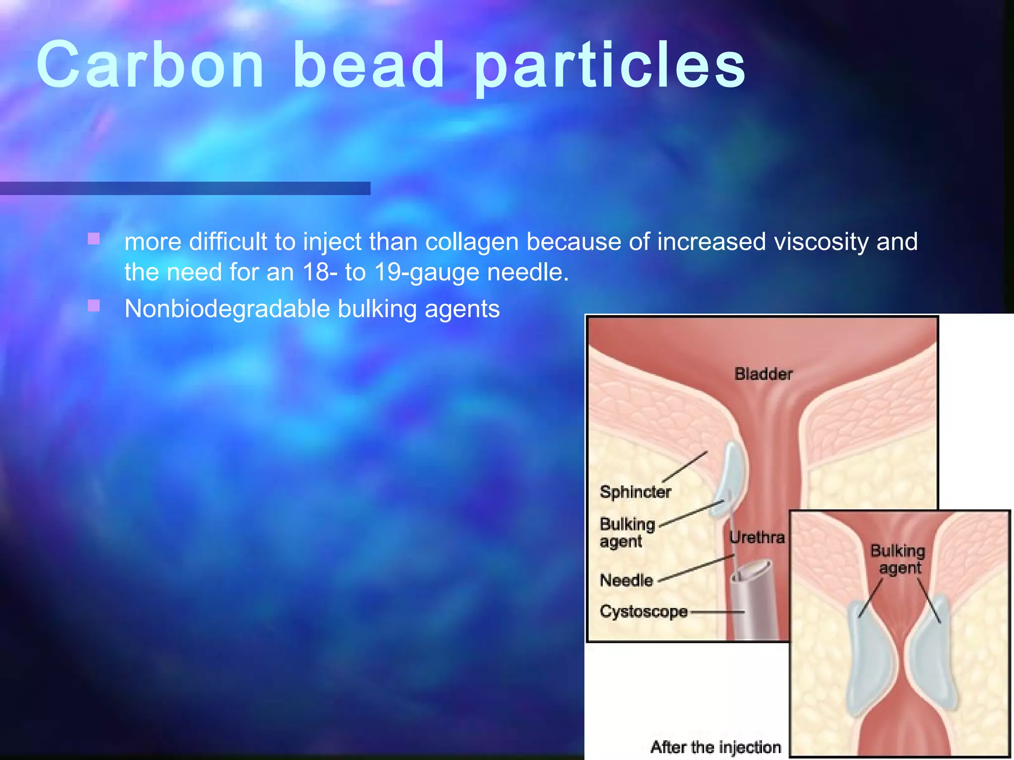 Injectable materials for stress incontinence in males | PPT