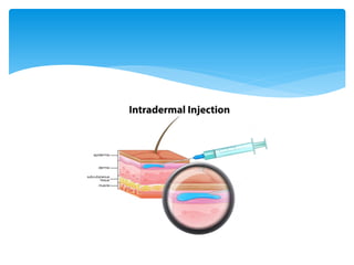 injection.pdf