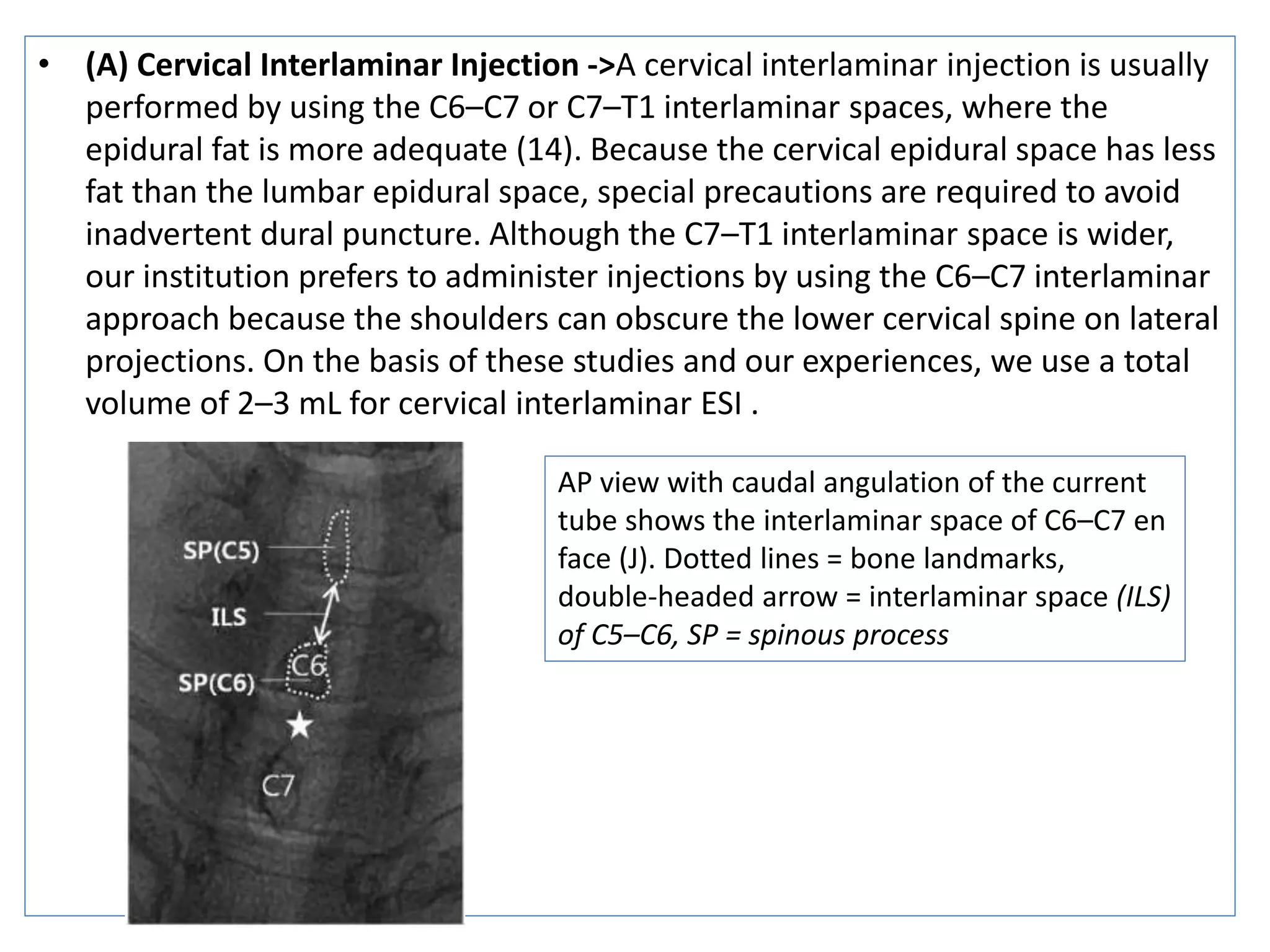 Injection in spine | PPTX