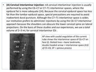 Injection in spine | PPTX