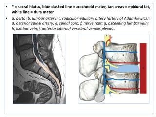 Sacral Hiatus Epidural