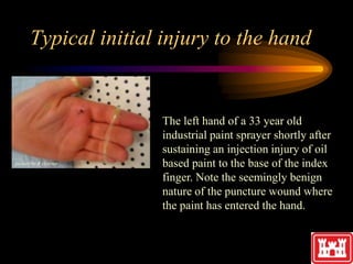 Fluid Injectioninjurytraining | PPSX